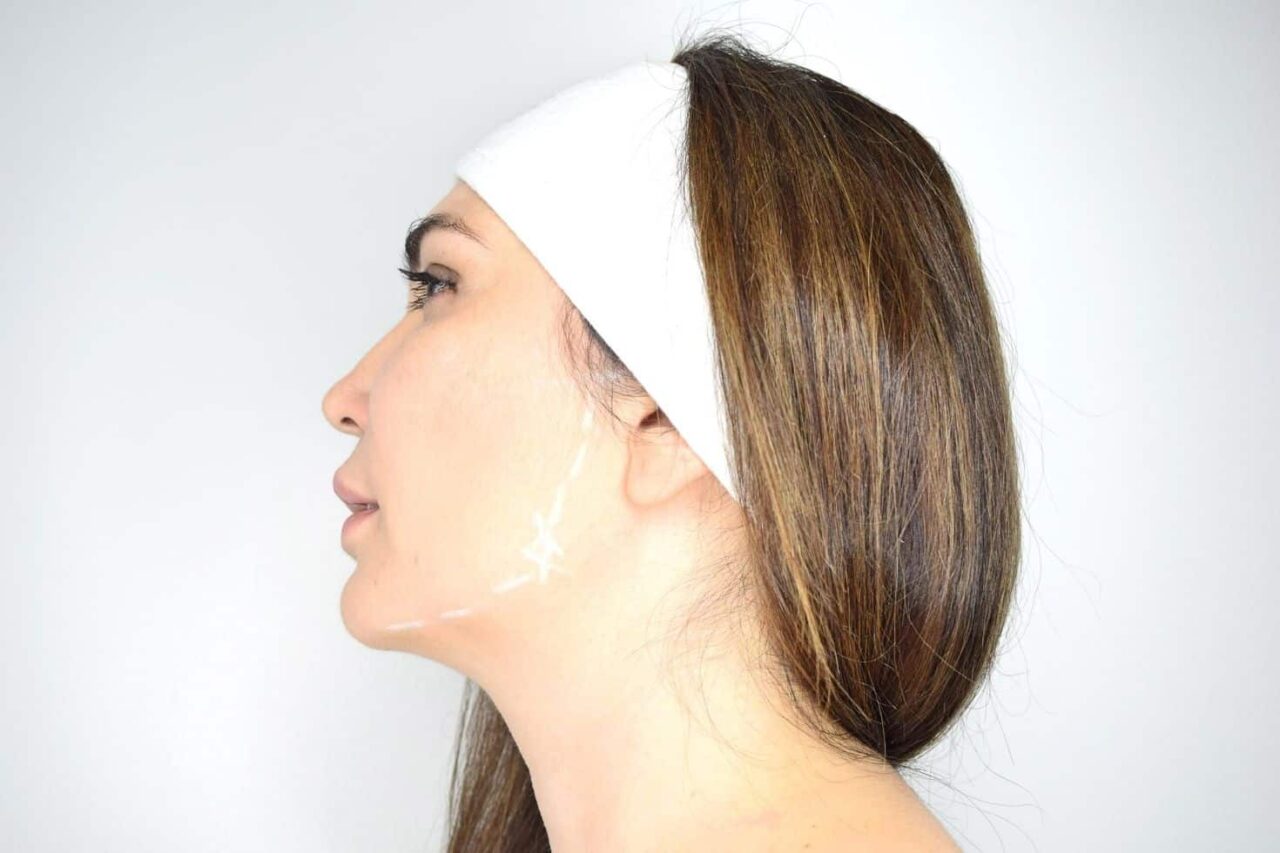 Jawline contouring | Derma Institute