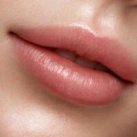 Models - Derma Institute